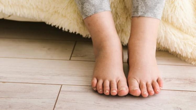 10 Tips for Treating Swollen Feet at Home - Freshers web